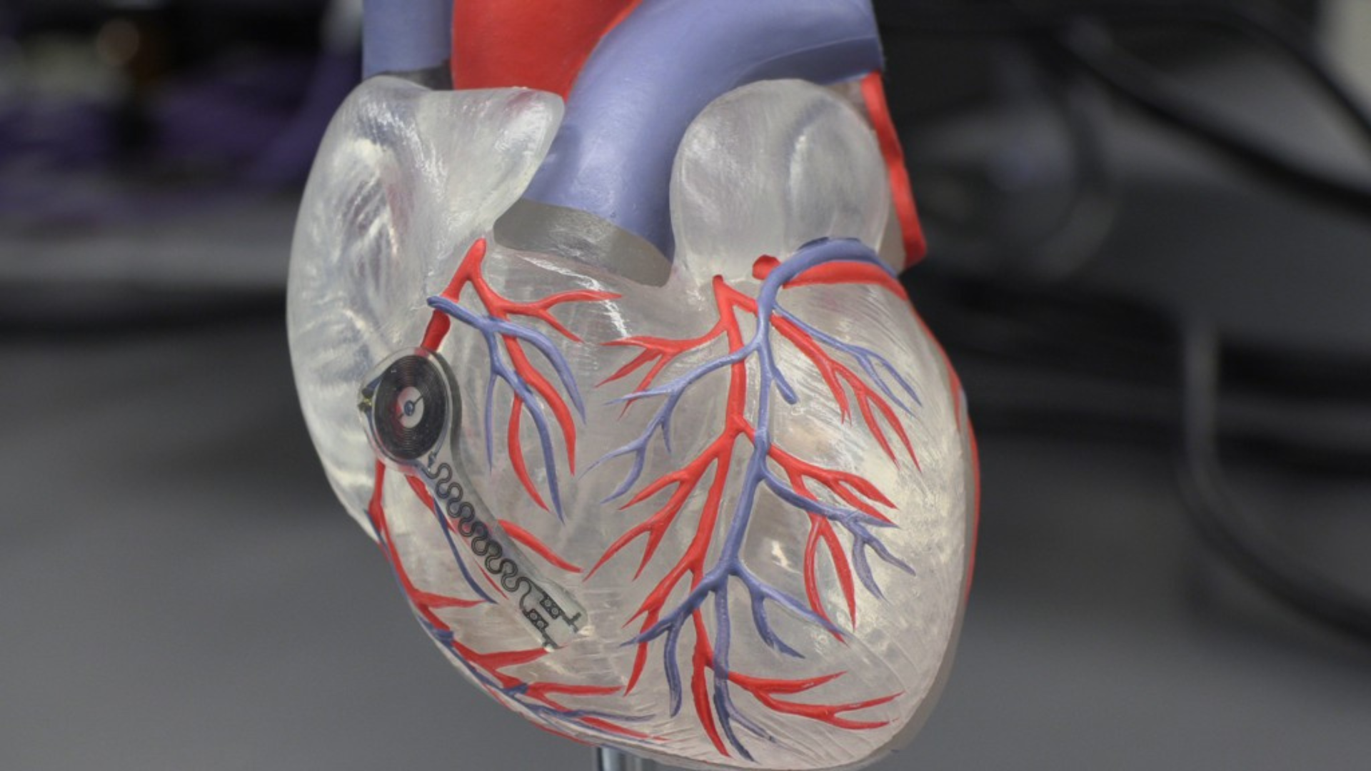 The heart: a pacemaker that can be reabsorbed