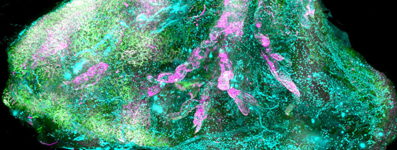 More effective treatments thanks to “transparent”organs | IBSA Foundation