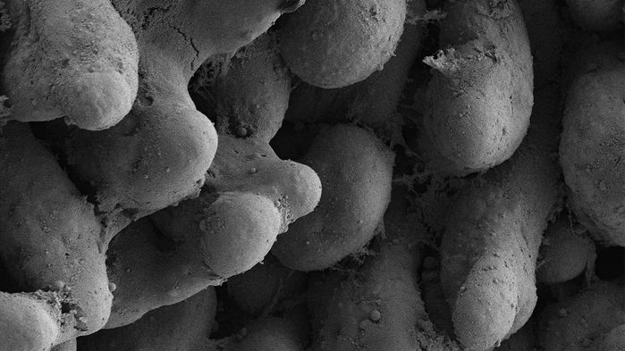 Recreate the intestine? You can, thanks (also) to a spring | IBSA ...